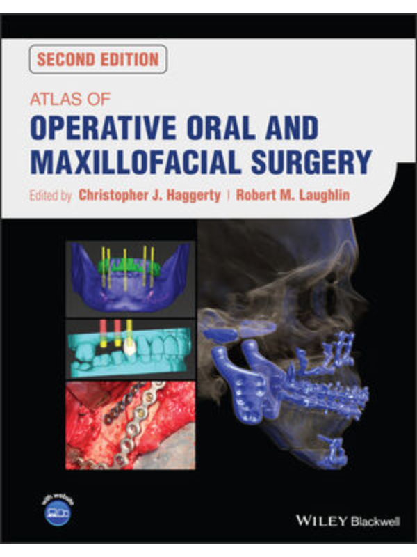 Atlas of Operative Oral and Maxillofacial Surgery, 2nd Edition