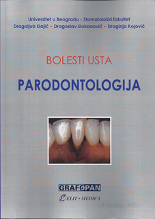 Bolesti usta parodontologija : oralna žarišta i konsekutivna oboljenja – tzv. fokalna infekcija. Parodontologija