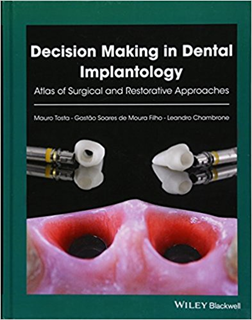 Decision Making In Dental Implantology