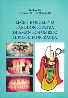 Lečenje oboljenja parodontopatija dijamantom umesto hirurških operacija