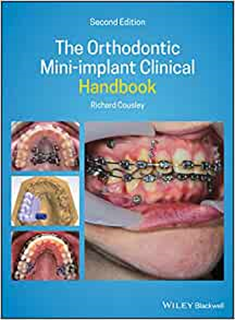 Orthodontic Mini implant Handboo