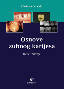 Osnovi zubnog karijesa