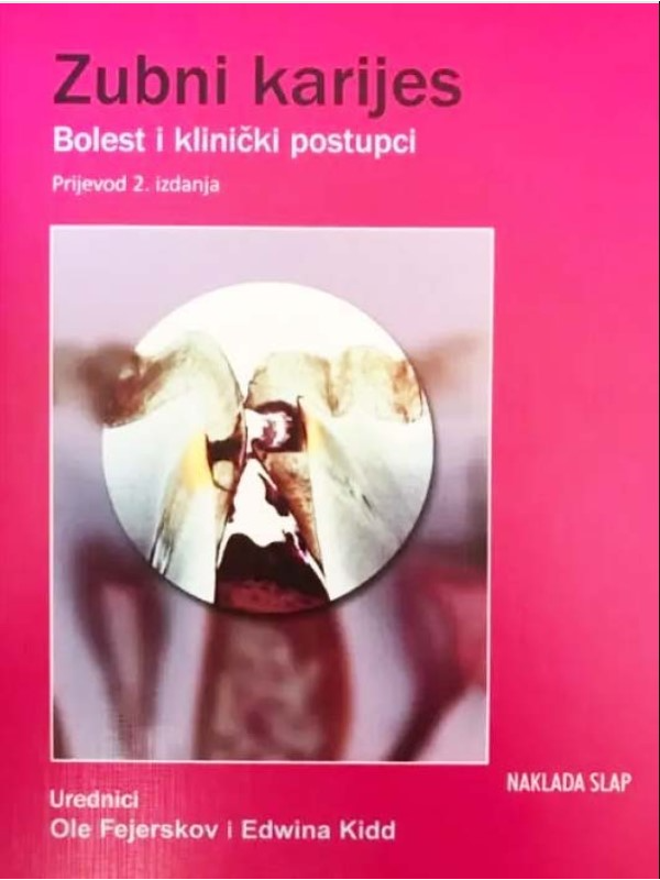 Zubni karijes-bolest i klinički postupci