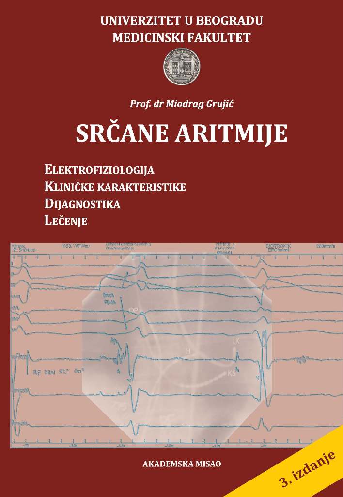 Srčane aritmije - Elektrofiziologija, Kliničke karakteristike, Dijagnostika, Lečenje