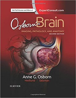 Osborn's Brain, 2nd Edition