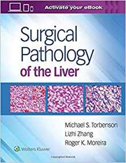 Surgical Pathology of the Liver