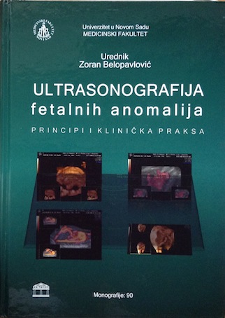 Ultrasonografija fetalnih anomalija: Principi i klinička praksa