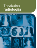 Torakalna radiologija