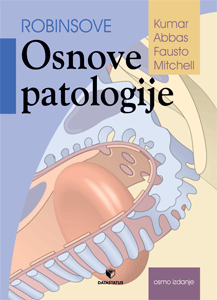 Robinsove osnove patologije