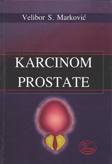 Karcinom prostate