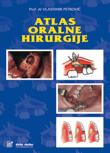 Atlas oralne hirurgije