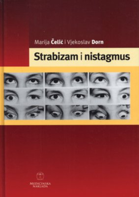 Strabizam i nistagmus