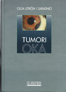 Tumori oka