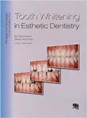 Tooth Whitening in Esthetic Dentistry: Principles and Techniques/Communication Tools