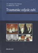 Traumatske ozljede zubi