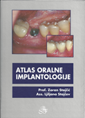 Atlas oralne implantologije