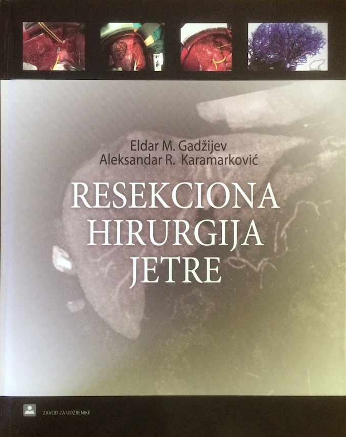 Resekciona hirurgija jetre + CD