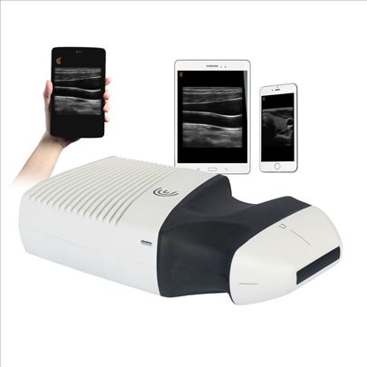 Clarius L7 mobilni portabilni ultrazvuk - bezicni