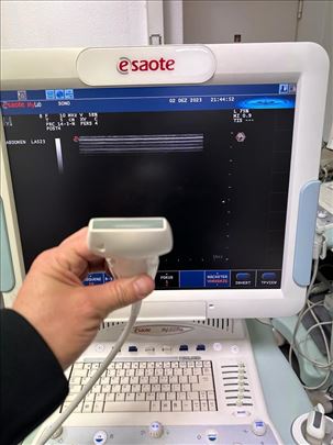 Ultrazvuk internistički-ultrazvučni aparat