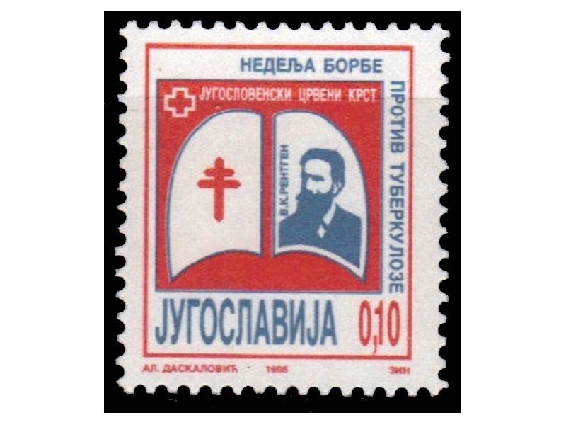 DOPLATNA TUBERKULOZA 1995