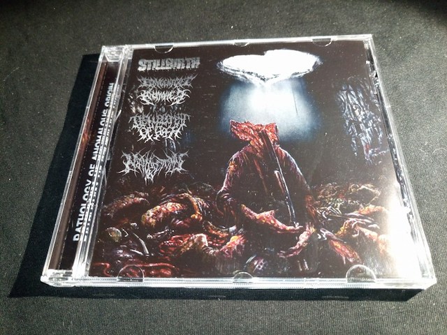 Pathology of anomalous origin -Kompilacija