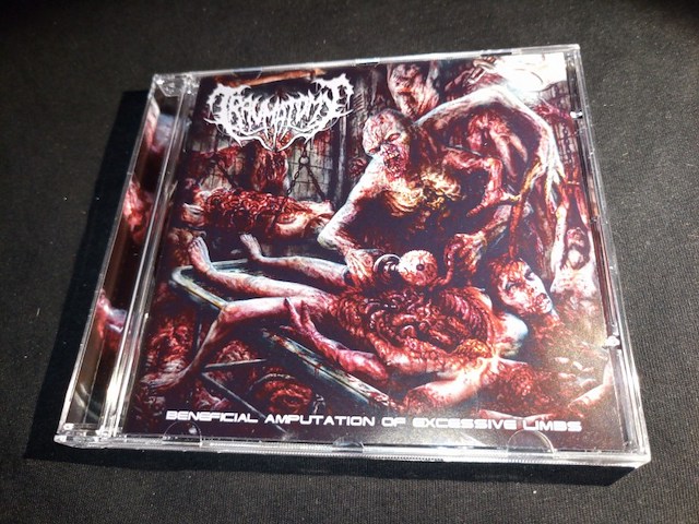 Traumatomy – Beneficial Amputation Of Excessive Limbs
