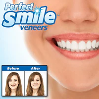 Perfect smile navlaka za zube