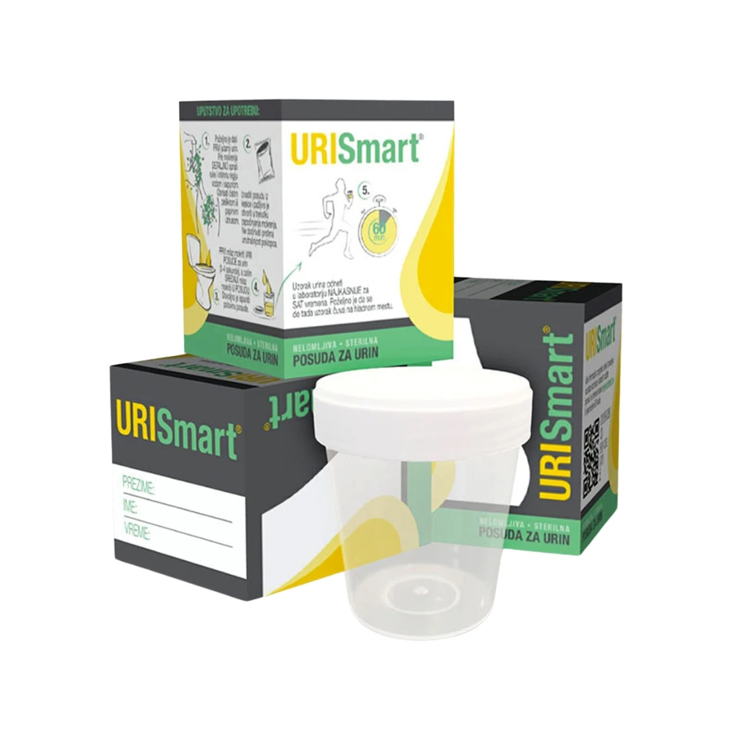 URISmart® Sterilna Posuda za Uzorkovanje Urina