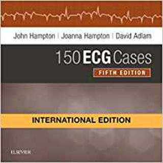 150 Ecg Cases, International Edition