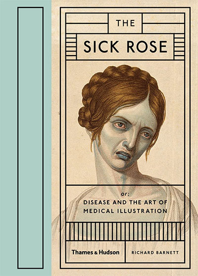 The Sick Rose: Or; Disease and the Art of Medical Illustration