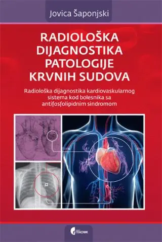 Radiološka dijagnostika patologije krvnih sudova - Jovica Šaponjski