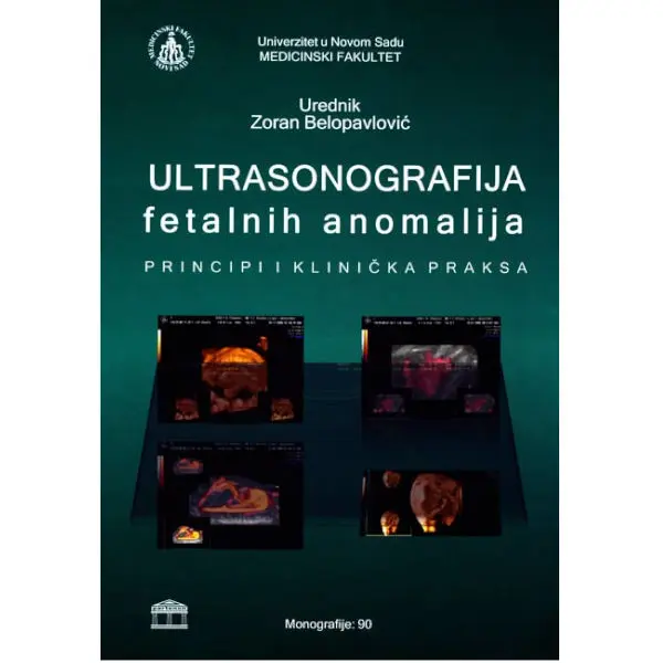 Ultrasonografija fetalnih anomalija - Zoran M. Belopavlović, Grupa Autora