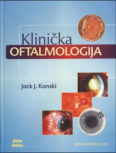 Klinička oftalmologija - Džek Kanski