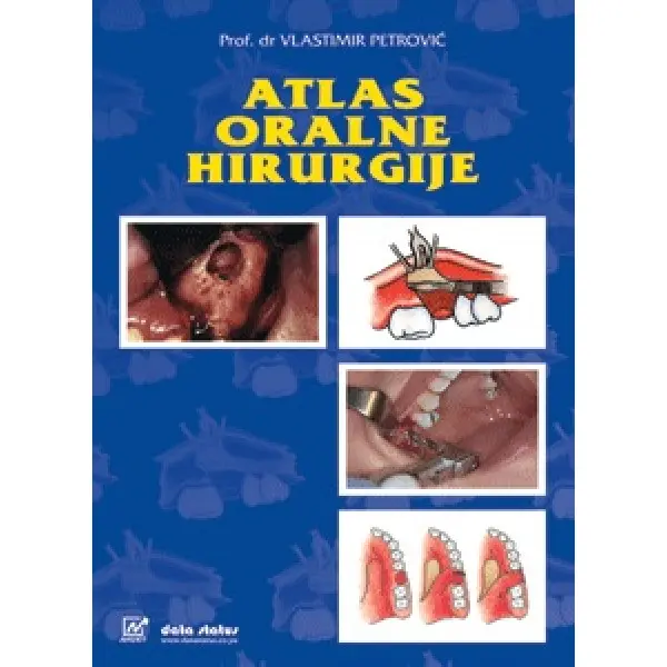 Atlas oralne hirurgije - Vlastimir Petrović