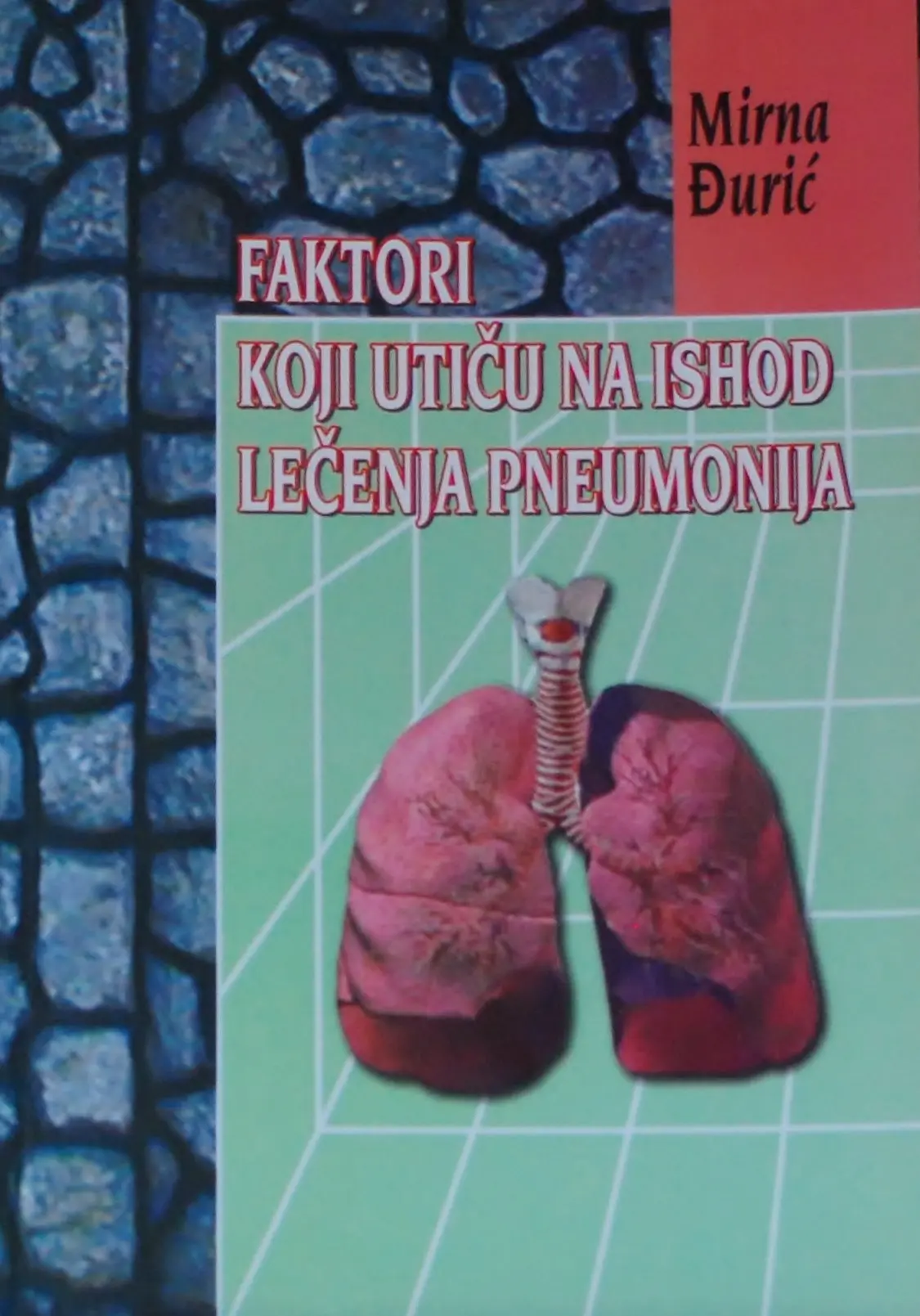 Faktori koji utiču na ishod lečenja pneumonija - Mirna Đurić