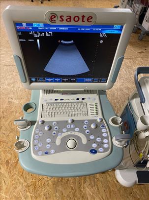 Ultrazvuk-ultrazvucni aparat
