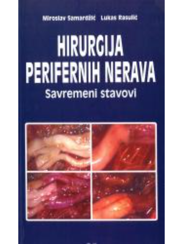 Hirurgija perifernih nerava-savremeni stavovi