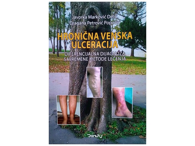 Hronična venska ulceracija-diferencijalna dijagnoza - V