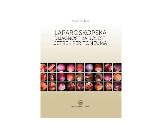 Laparoskopska dijagnostika bolesti jetre i peritoneuma