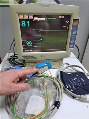 Pacijent monitor Nikon Kohden sa printerom