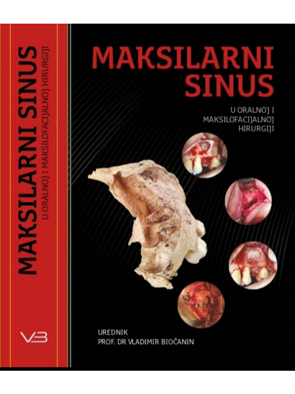 Maksilarni sinus u oralnoj i maksilofacijalnoj hirurgiji