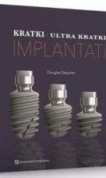 Kratki I Ultra Kratki Implantati Od Douglas Deporter