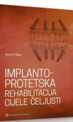 Implantoprotetska Rehabilitacija Cijele Čeljusti Od Arun K. Garg