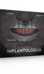 Dentalna Implantologija Od Tomislav Ćabov, Zoran Kovač