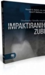 Ortodontska I Kirurška Terapija Impaktiranih Zubi Od Kokich, Vincent G., Mathews, David P.