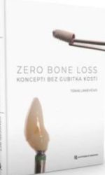 Zero Bone Loss: Koncepti Bez Gubitka Kosti Od Tomas Linkevicius