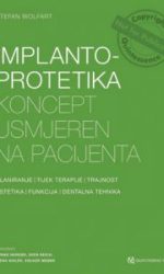 Implantoprotetika: Koncept Usmjeren Na Pacijenta Od Stefan Wolfart