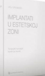 Implantati U Estetskoj Zoni Od Ueli Grunder