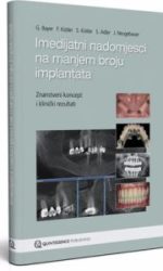 Imedijatni Nadomjesci Na Manjem Broju Implantata Od G. Bayer, F. Kistler, S. Kistler, S. Adler, J. Neugebauer