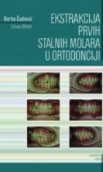 Ekstrakcija Prvih Stalnih Molara U Ortodonciji Od Borko Čudović